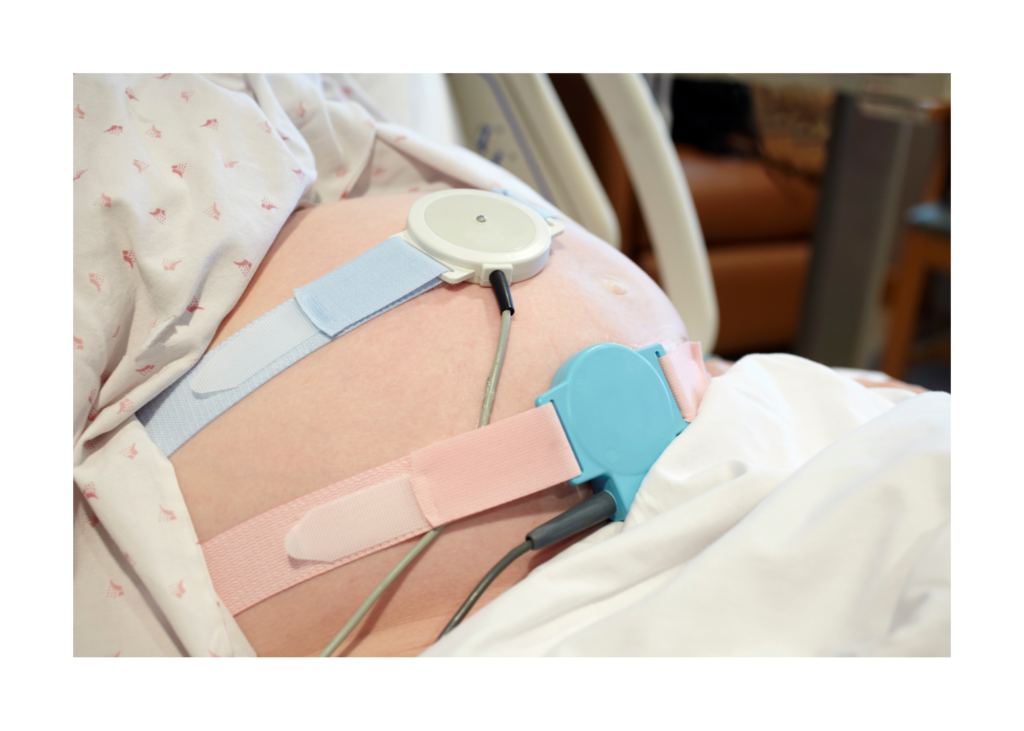 You're Having Contractions: A Non-Stress Test - Midwest Doulas